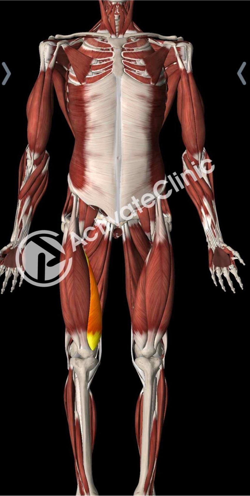Why Your Knee Gives Way and How to Stop It - Activate Clinic